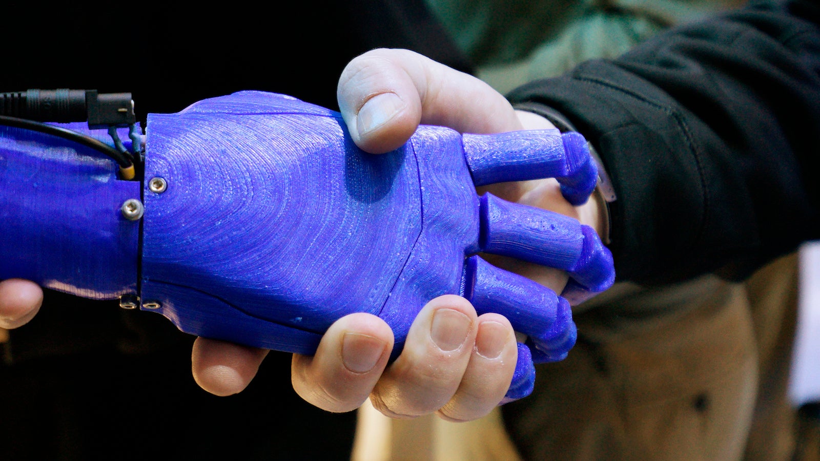 Modern prosthetics go beyond artificial limbs—and into the human brain